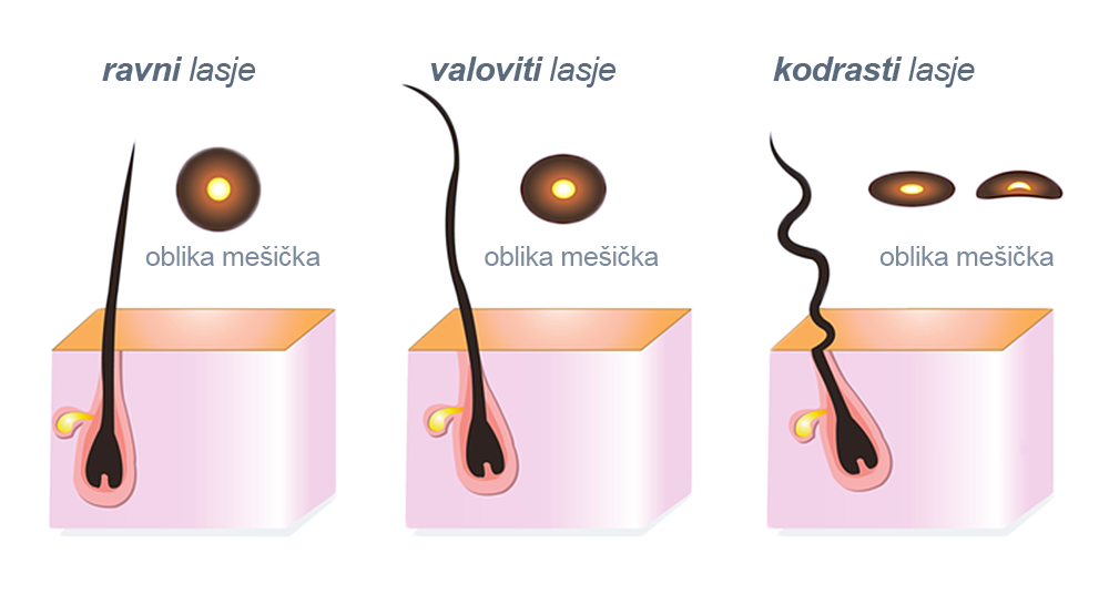 Naravna smer rasti in nakodranost las » Mentor Ema Pavičevič